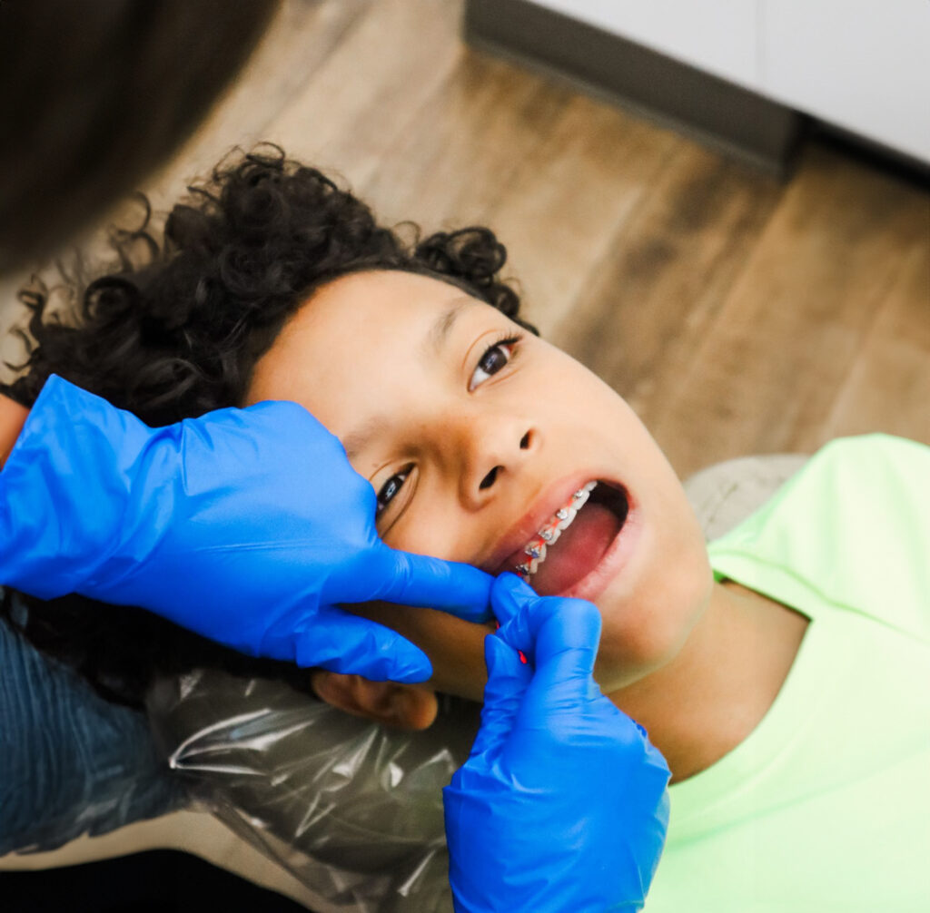 Advanced Braces in Greenville & Spartanburg | Palmetto Family Orthodontics